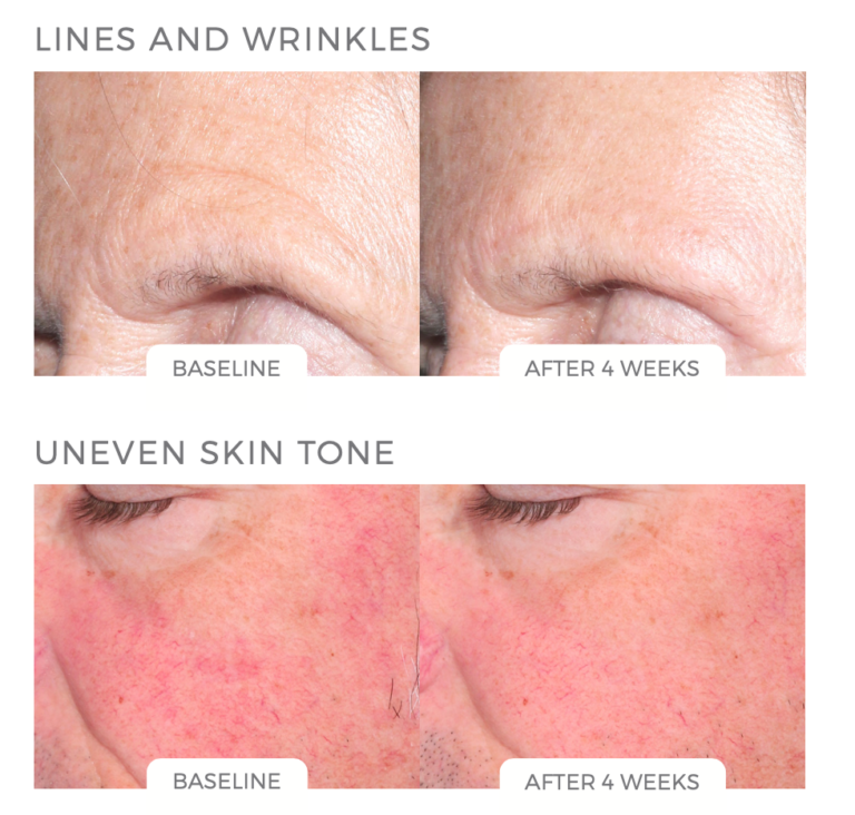 Age Reverse System | The Rejuva Center Store